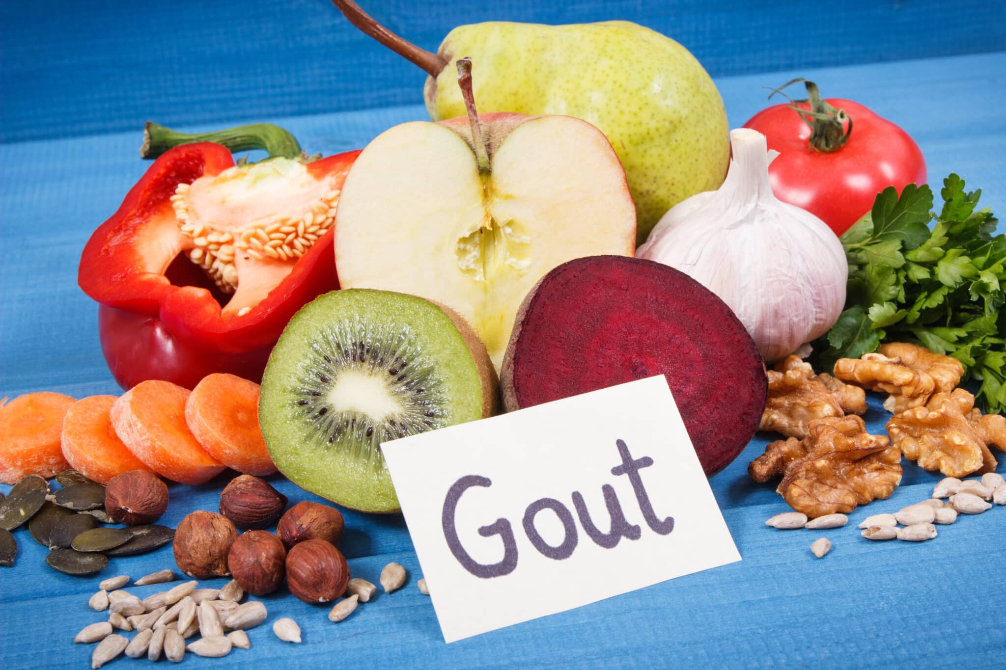 How Long Does Gout Last? - Physio Ed.